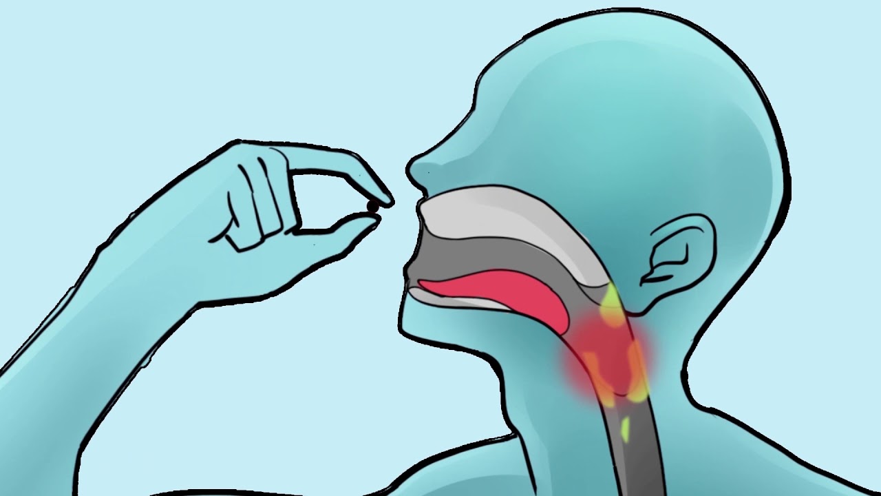 Capung Herbal Pastilles - Makanan Manis - YouTube