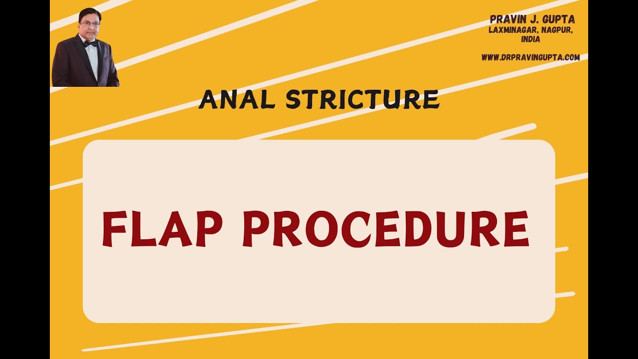ANAL STRICTURE SURGERY BY HOUSE FLAP PROCEDURE - YouTube