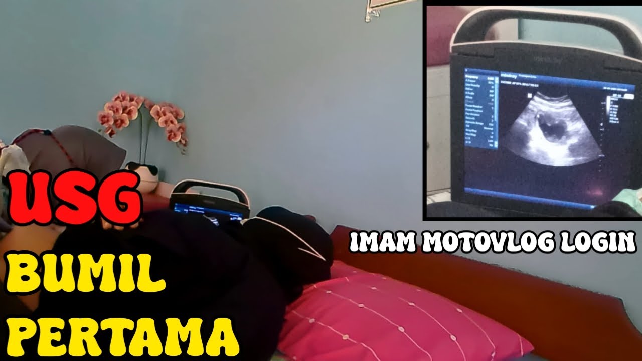 USG PERTAMA BUMIL‼️login imam motovlog junior#@imammotovlog6540 @Aim ...