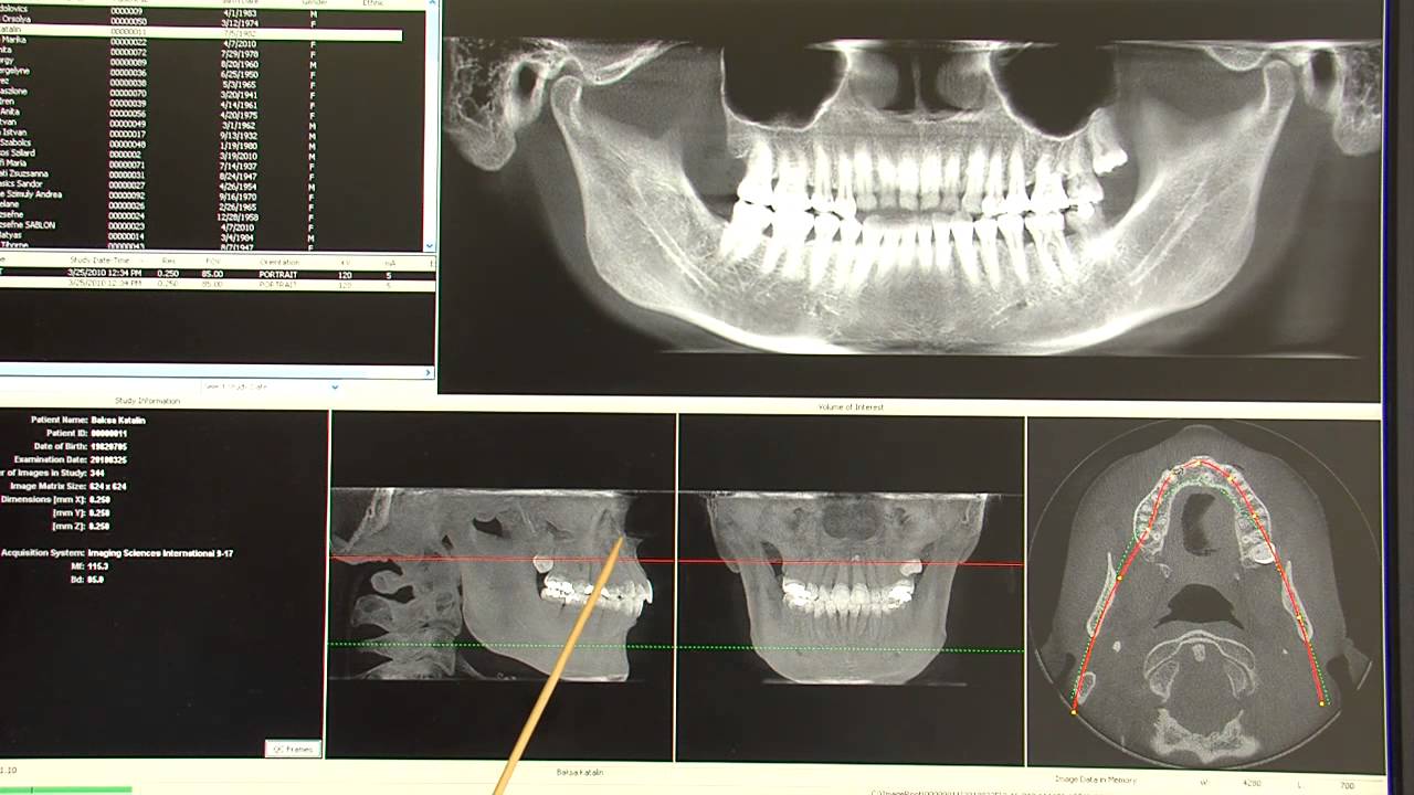 Dr. Iván és Tsa Fogorvosi rendelő Zalaegerszeg - 3D CT koponya röntgen ...