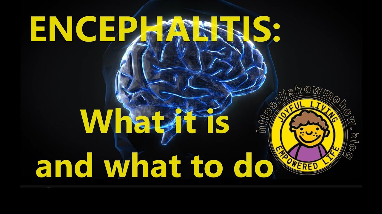 Encephalitis: What it is and What to do - YouTube