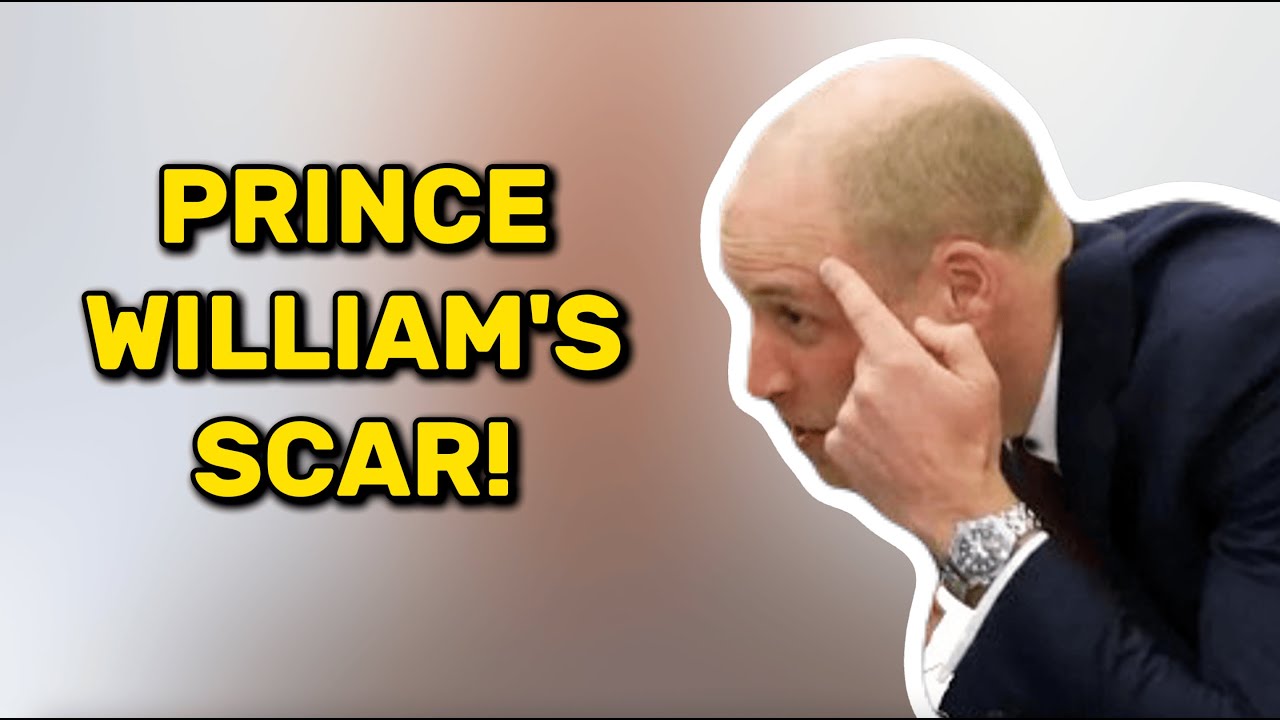 Prince William Shows Off SCAR During Visit to Cardiff! - YouTube