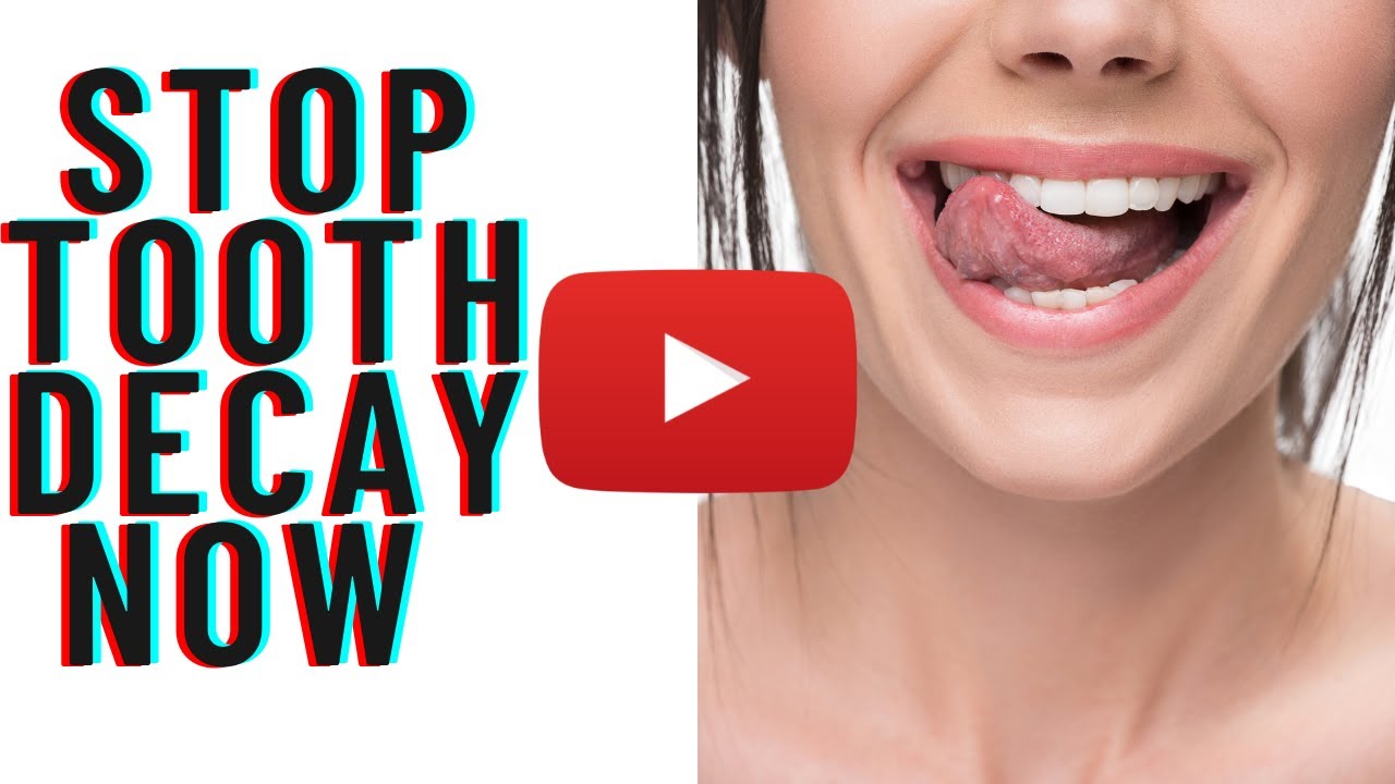Stop Tooth Decay Now - YouTube