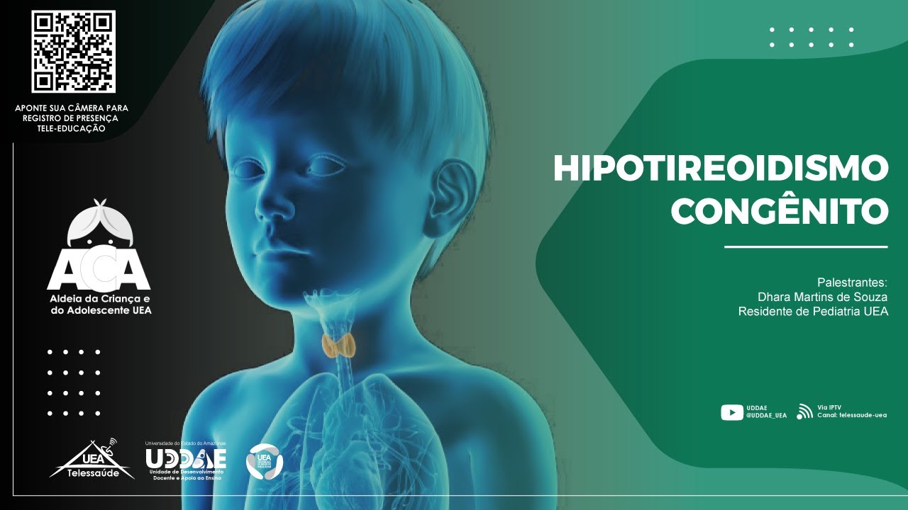 Hipotireoidismo Em Criancas Hipotireoidismo – Tireoidite De