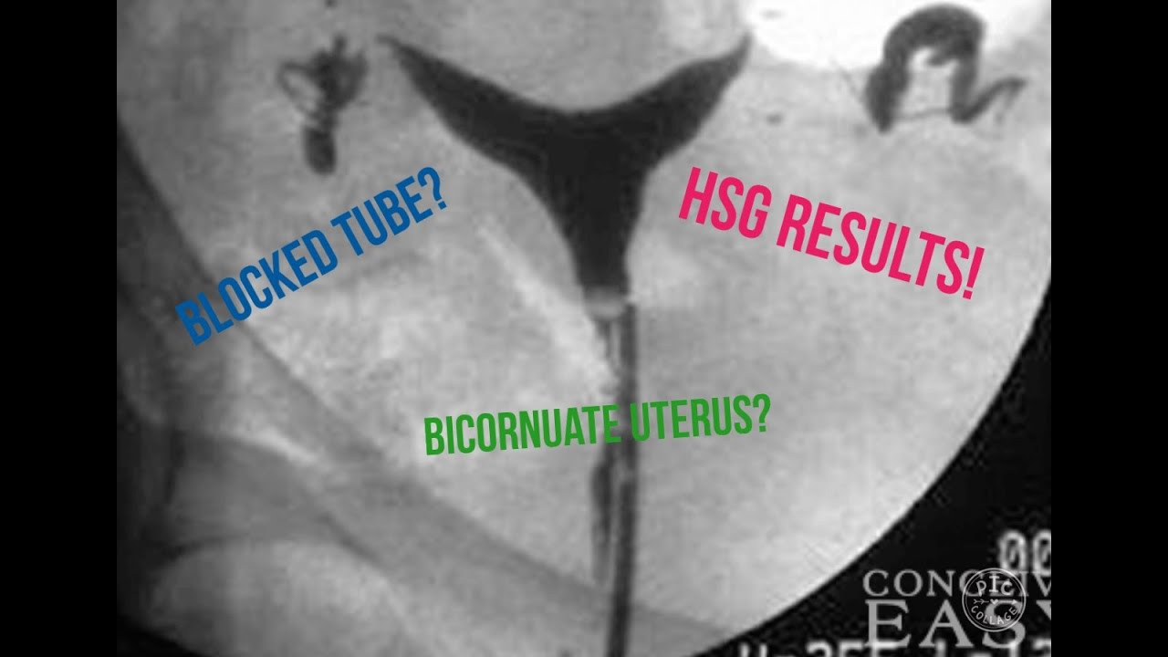 HSG Experience And Results YouTube