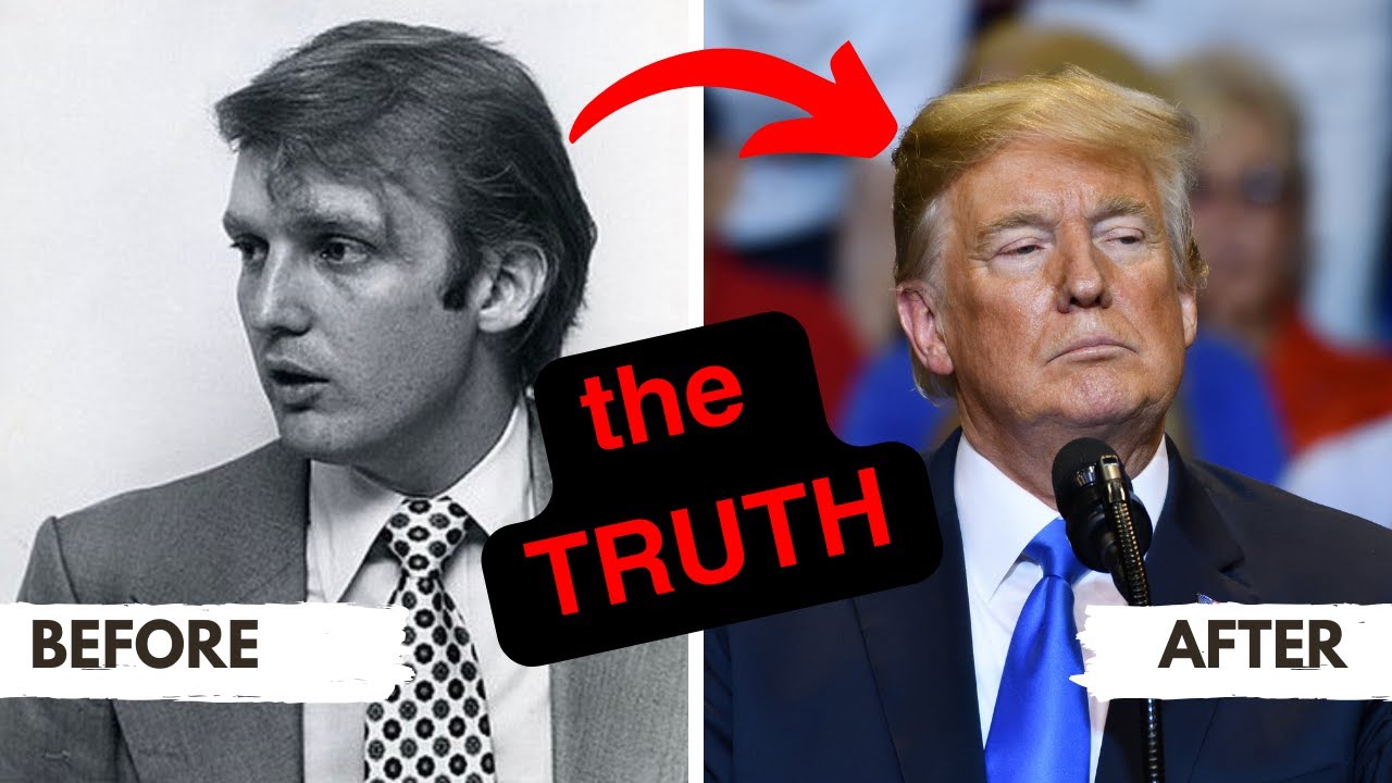 Donald Trump's Hair Secrets Exposed! - YouTube