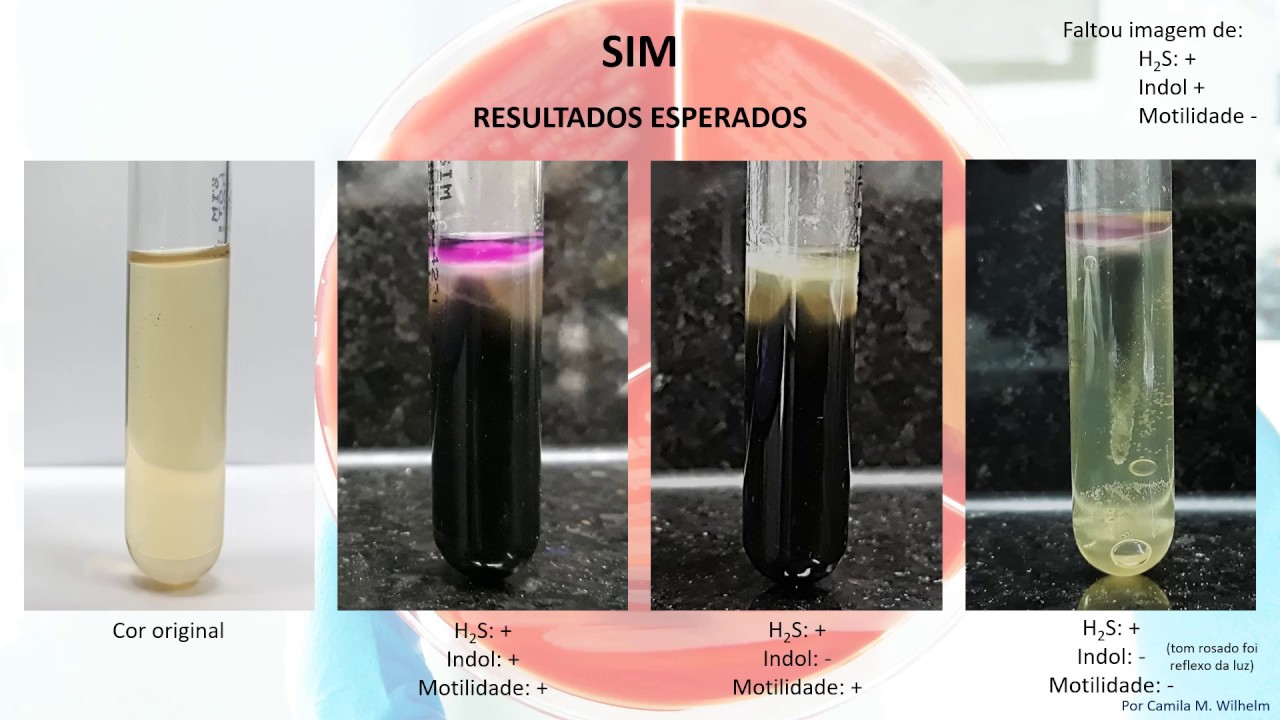 SIM - Sulfeto de hidrogênio Indol Motilidade - YouTube