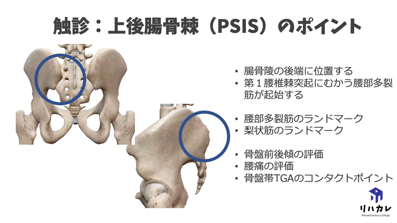 上後腸骨棘（PSIS）の触診のコツ[骨の触診] - YouTube