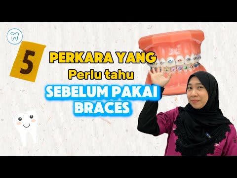 Nak Pakai Braces? : 5 Perkara Perlu Tahu! - YouTube