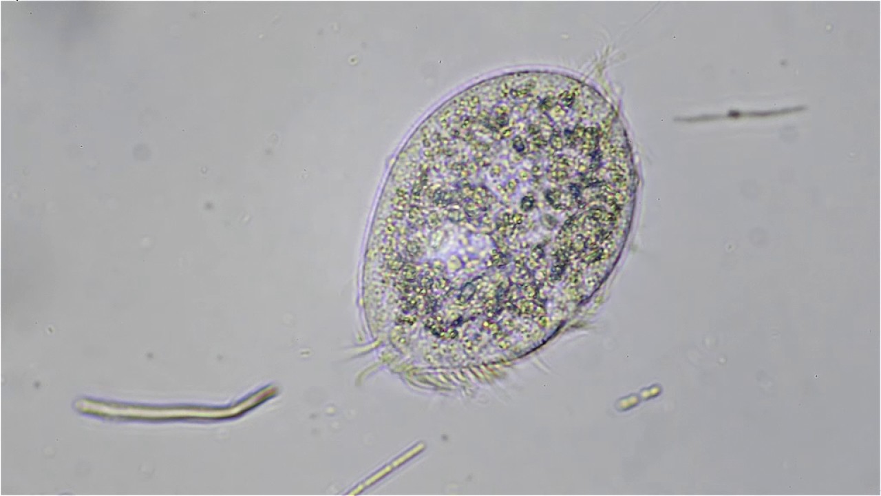 Unknown Small Ciliate - YouTube