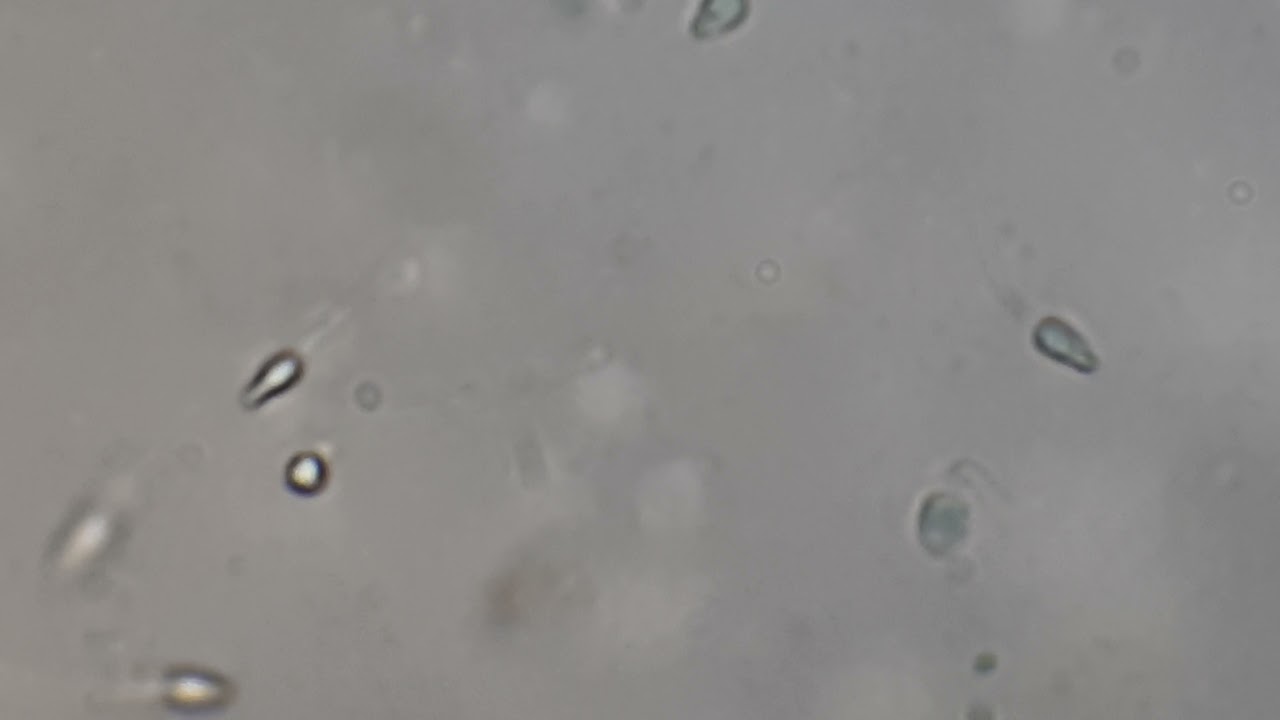 Sperm Microscope 400x