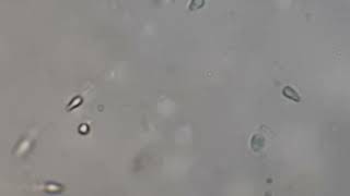 Semen Under Microscope