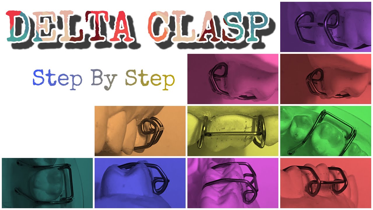 Delta Clasp||Fabrication Step By Step - YouTube