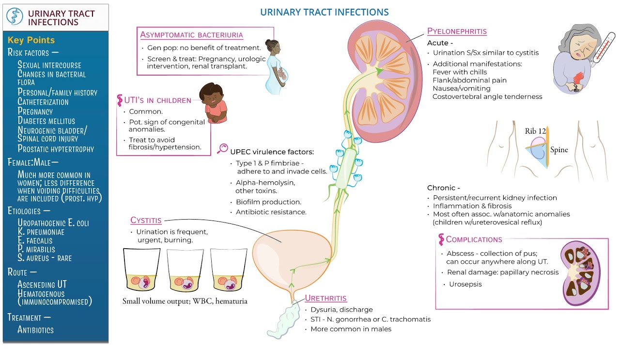 Complications of Cystitis inflammation of the bladder Acute and Chronic ...