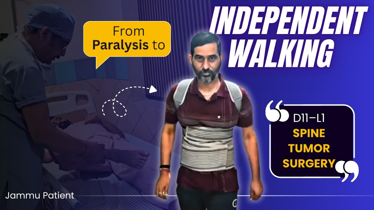 Jammu Patient | From Paralysis to Independent Walking | D11–L1 Spine ...