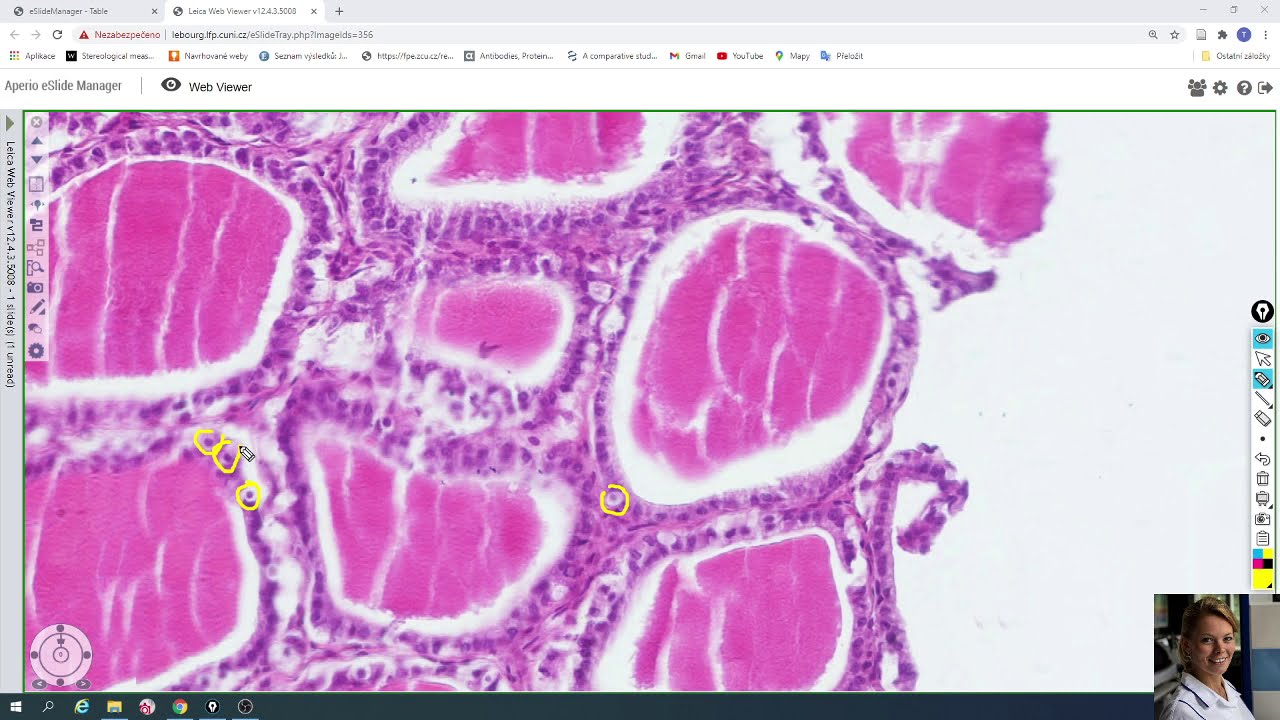 Thyroid Gland Slide Labeled