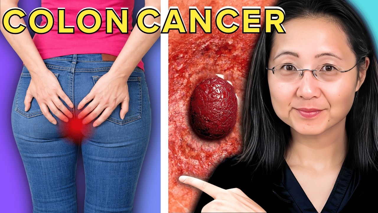 Beat Colon Cancer. 10 Early Signs. (Must Know) - YouTube