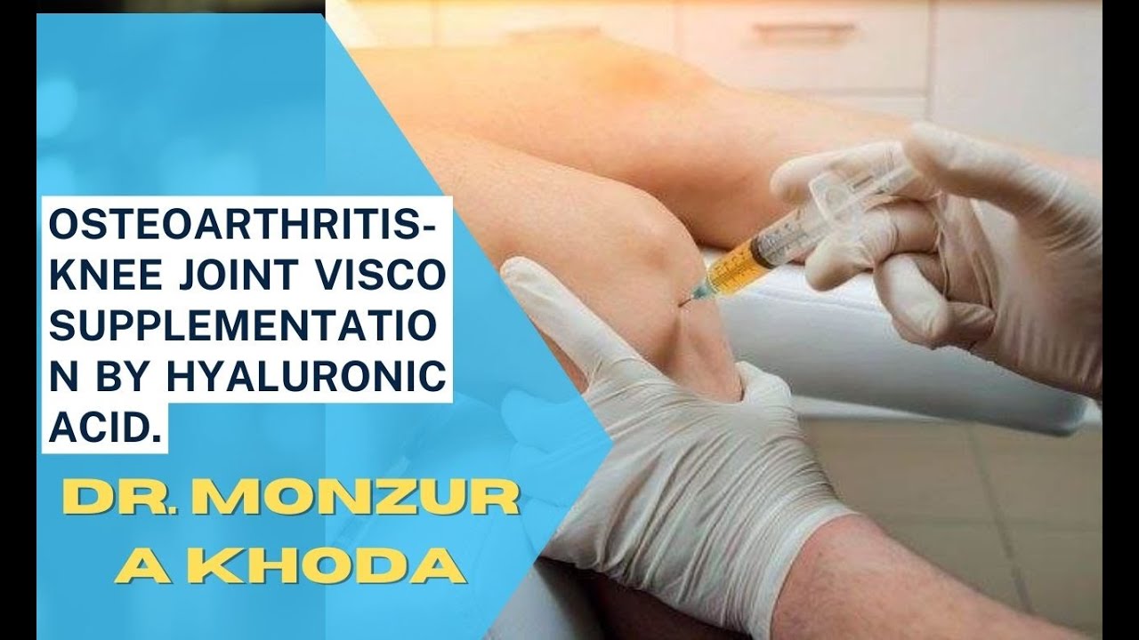 Osteoarthritis- Knee Joint Visco Supplementation by Hyaluronic Acid ...