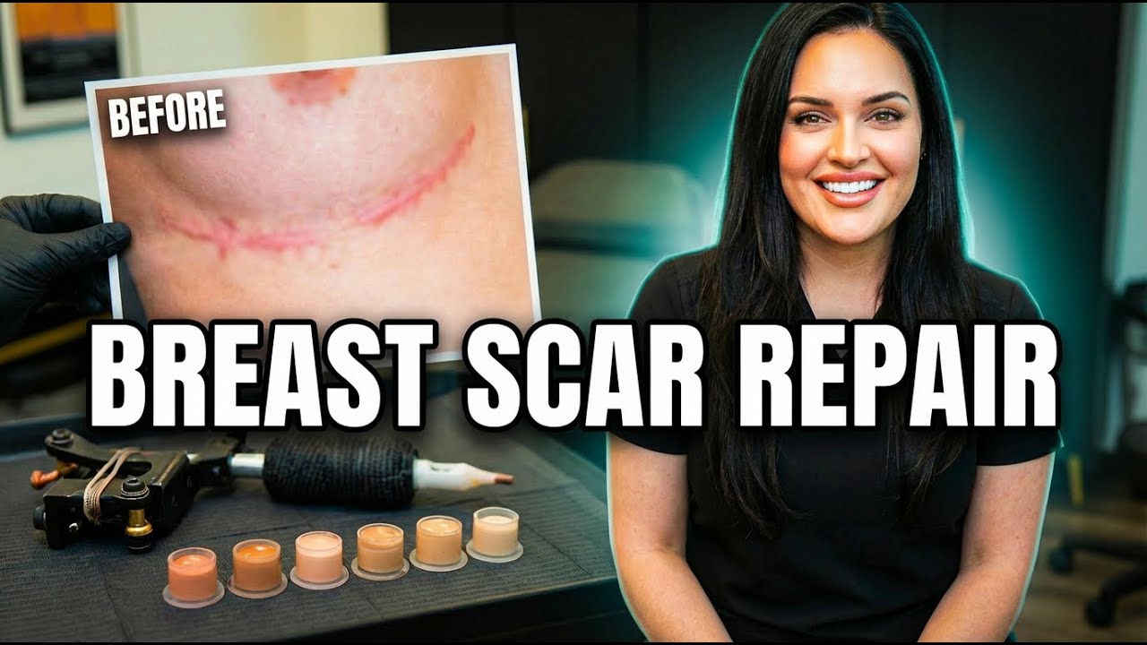 Severe Breast Lift Scar Camouflage | Real Client Journey - YouTube