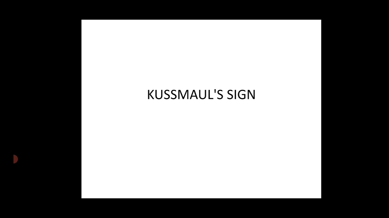 Kussmaul's sign & Kussmaul breathing - YouTube