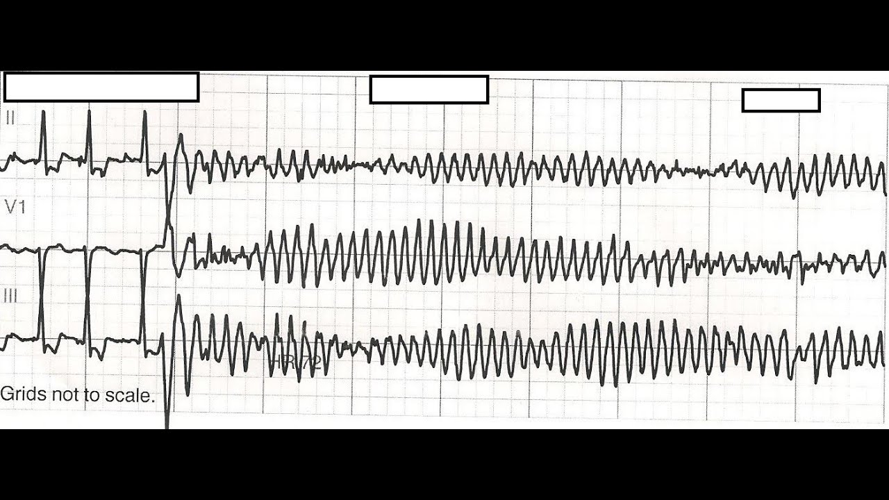 November 2025 SCEMSA Updates - YouTube