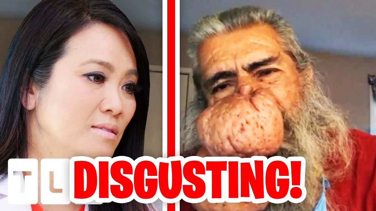 The Craziest And Most Disgusting Moments On Dr Pimple Popper Youtube