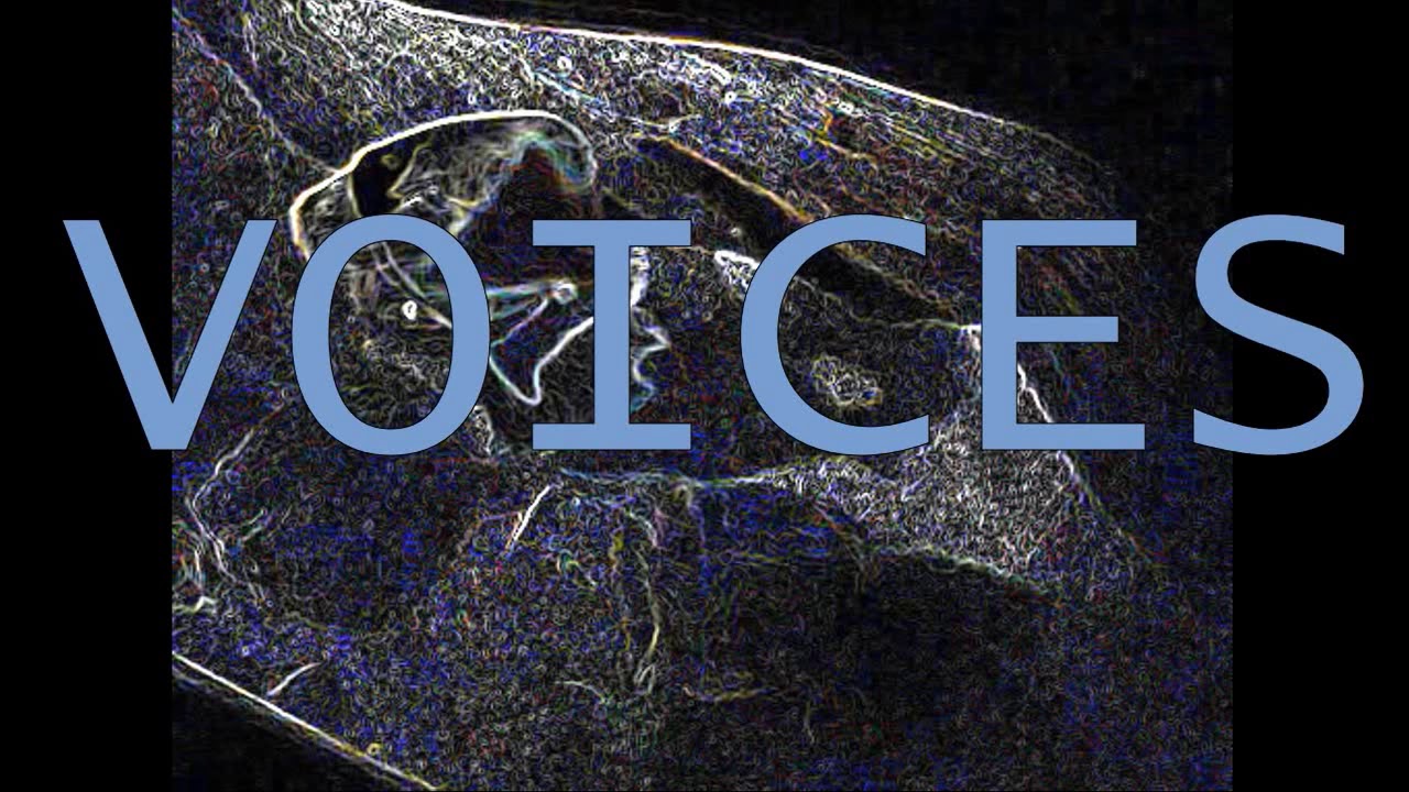 Skeleton - I forgot my password (audio) - YouTube