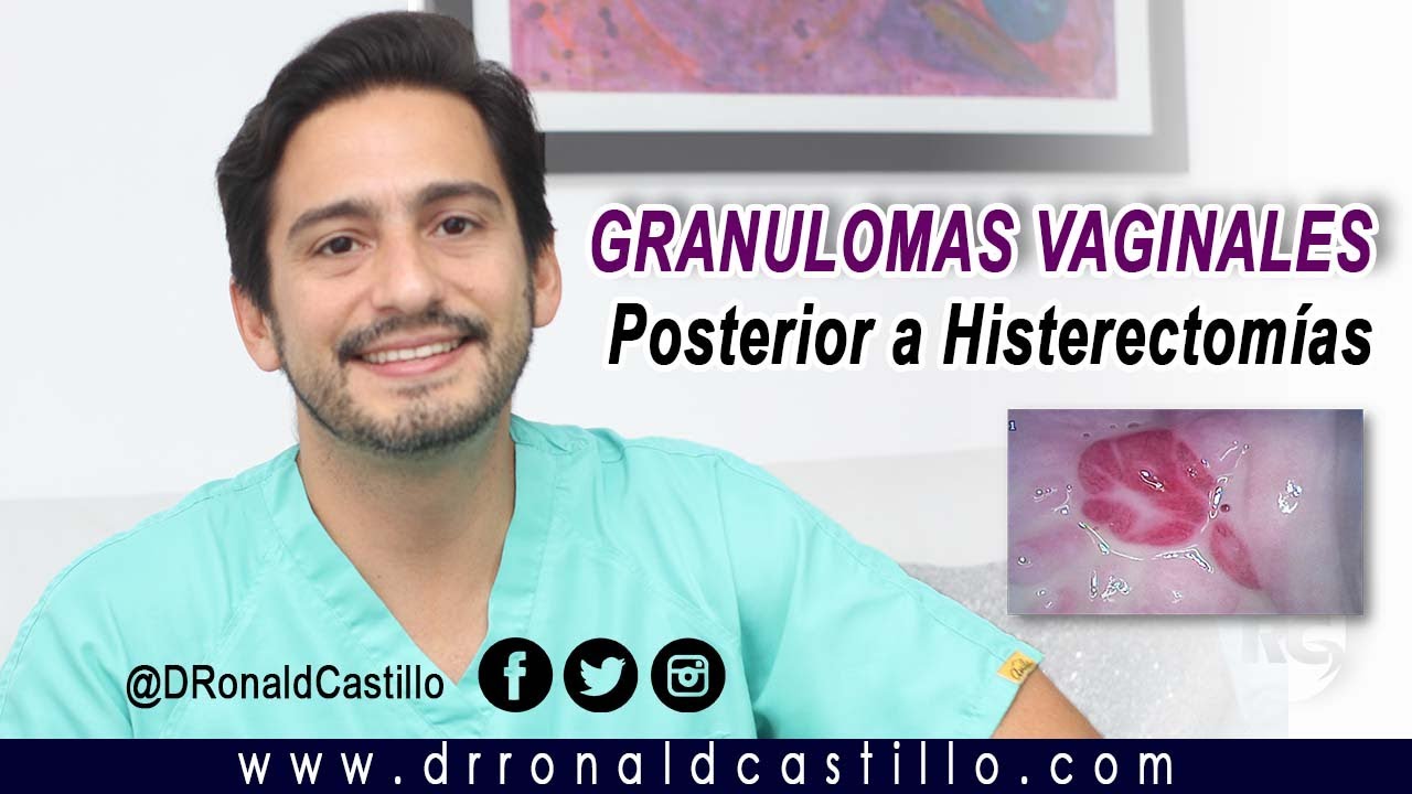 GRANULOMA VAGINAL POSTERIOR A UNA HISTERECTOMÍA: DEFINICIÓN, SÍNTOMAS Y ...