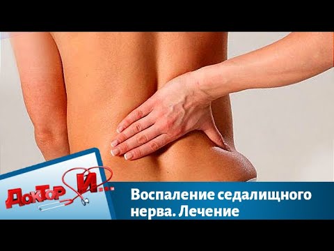 Воспаление седалищного нерва и его лечение | Доктор И - YouTube