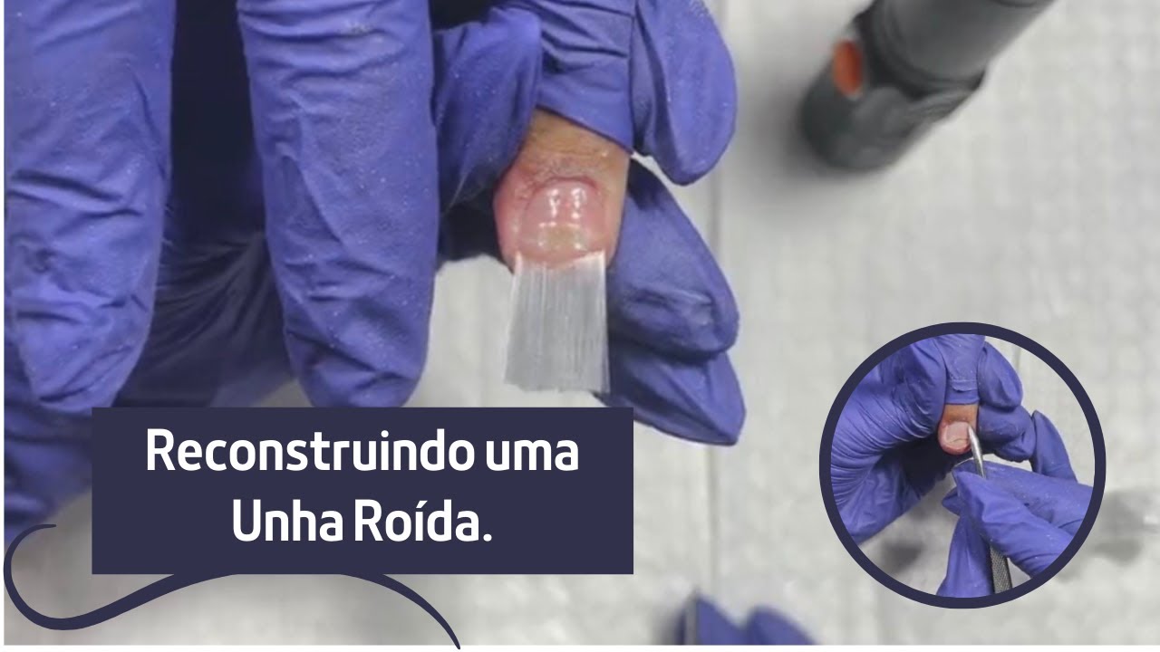 Você pensa que é DIFÍCIL fazer UNHA ROÍDA mas assim fica bem mais fácil ...