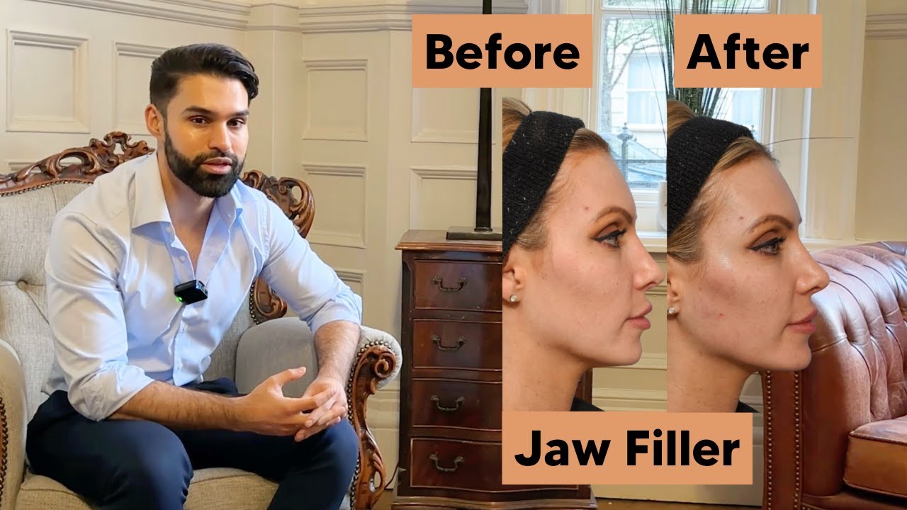 Jaw Filler for that Snatched Jawline - YouTube