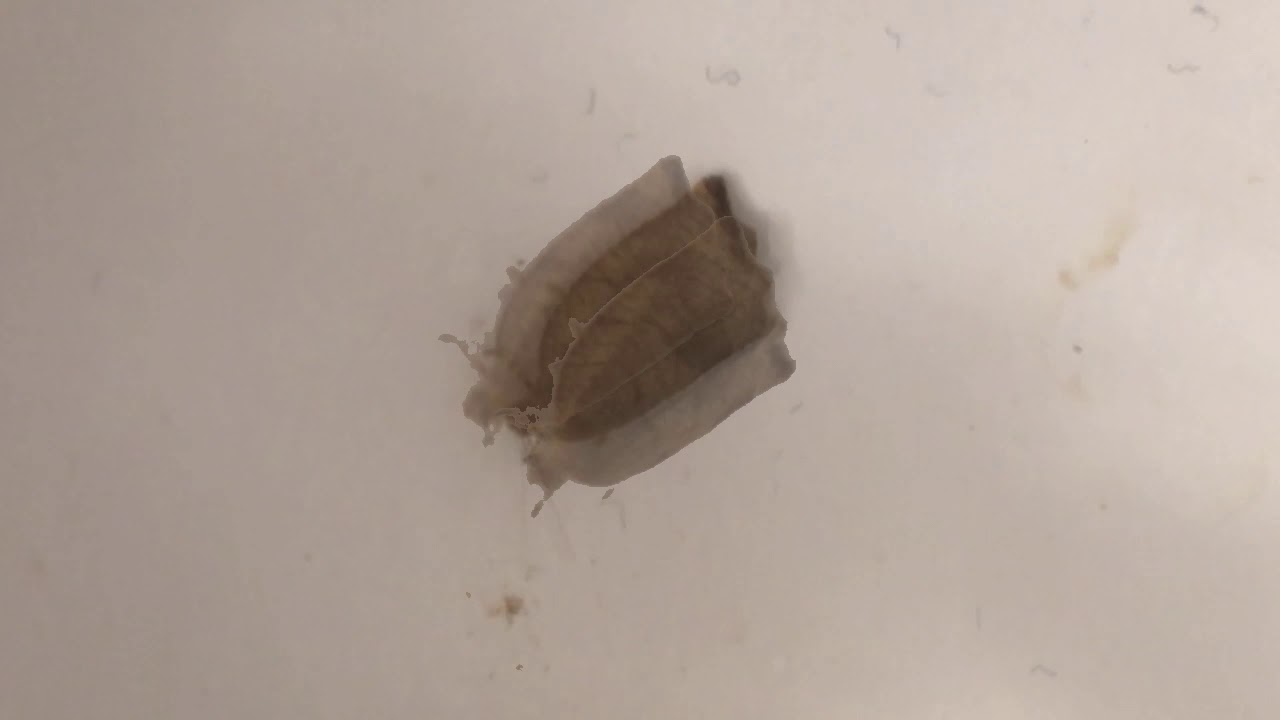 double bug :) - YouTube