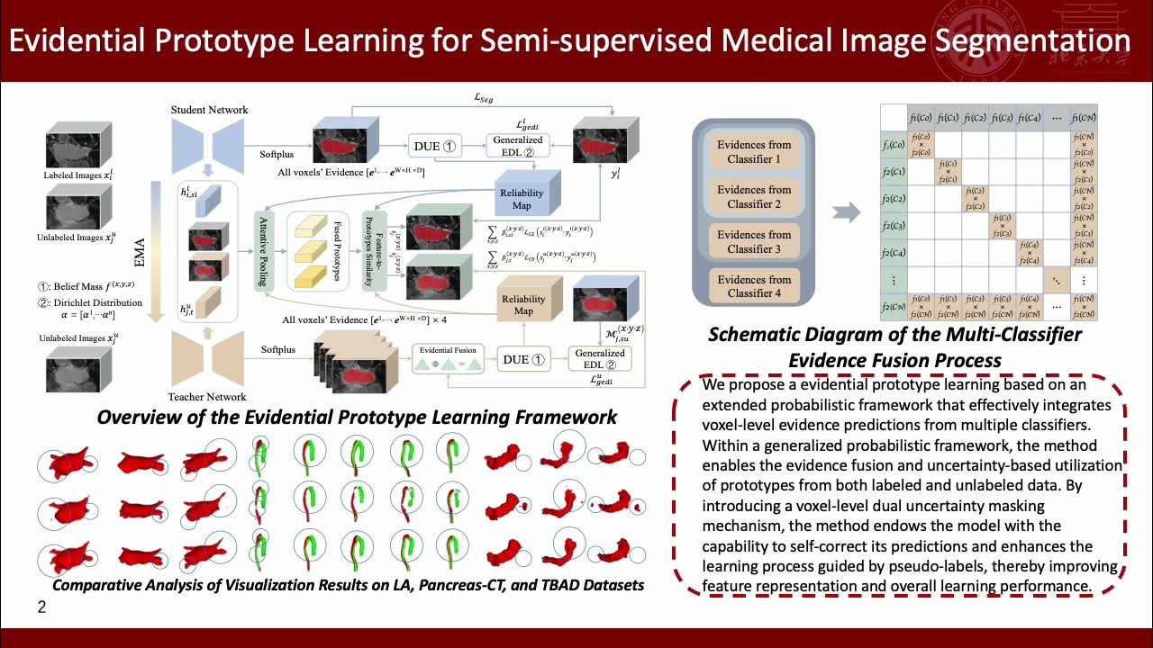 KDD 2025 - Evidential Prototype Learning for Semi-supervised Medical Image Segmentation - YouTube