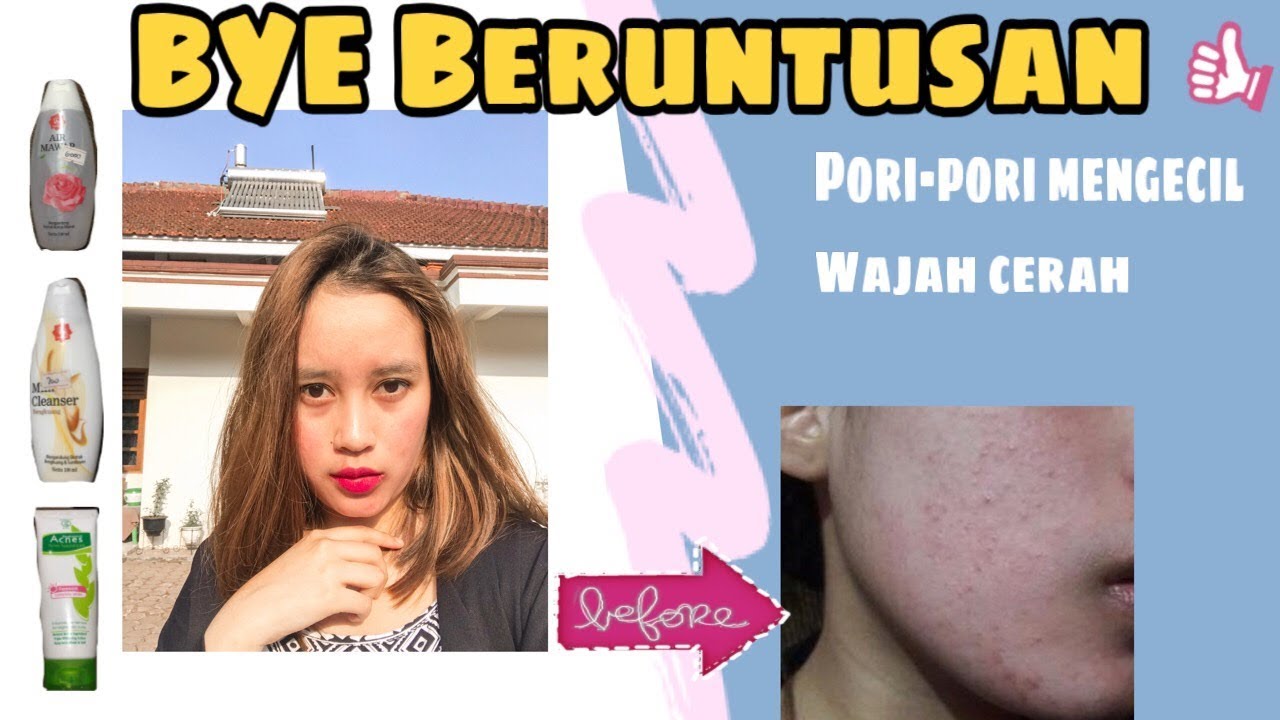 CARA MENGHILANGKAN BERUNTUSAN - VIVA & ACNES - BY FANI OKTAFIYANI - YouTube