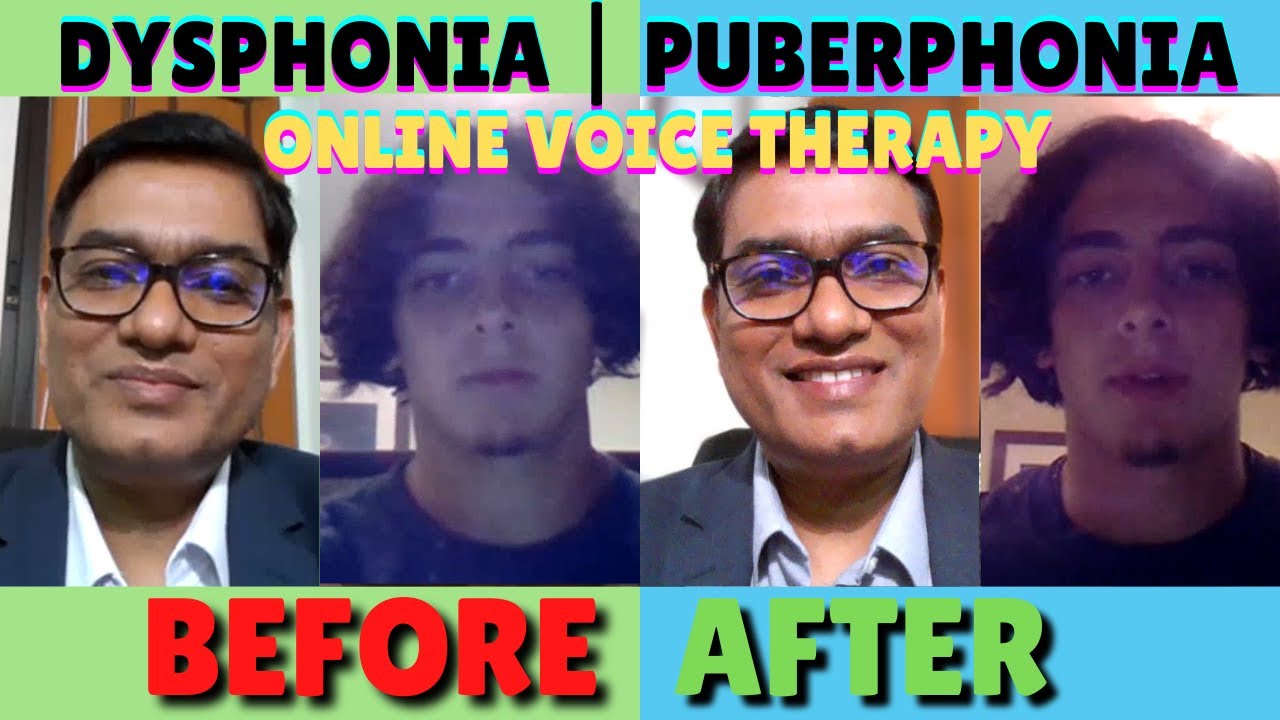 Pre-Post | Puberphonia | International Guy | No Surgery, Online Voice ...