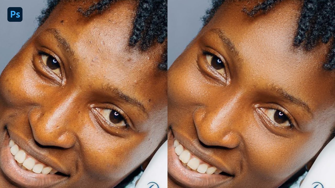 Blemish Removal In Photoshop: 4 Methods To Try - YouTube