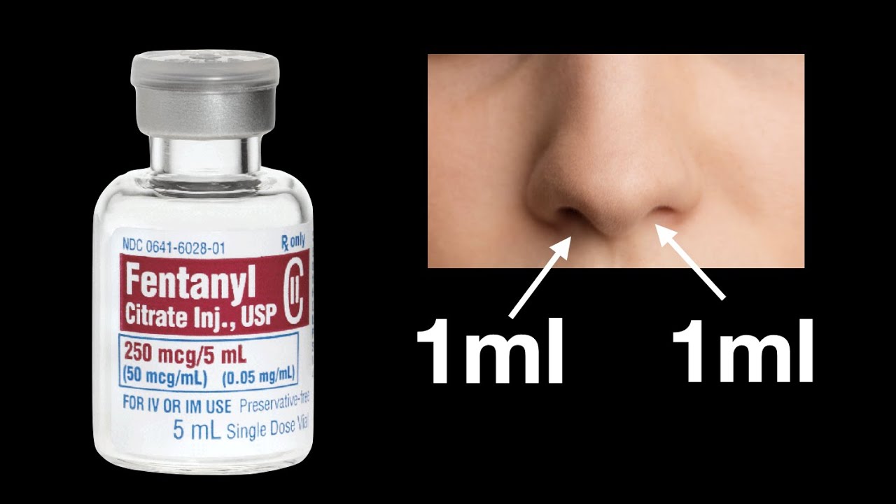Intranasal Delivery (or not) - YouTube