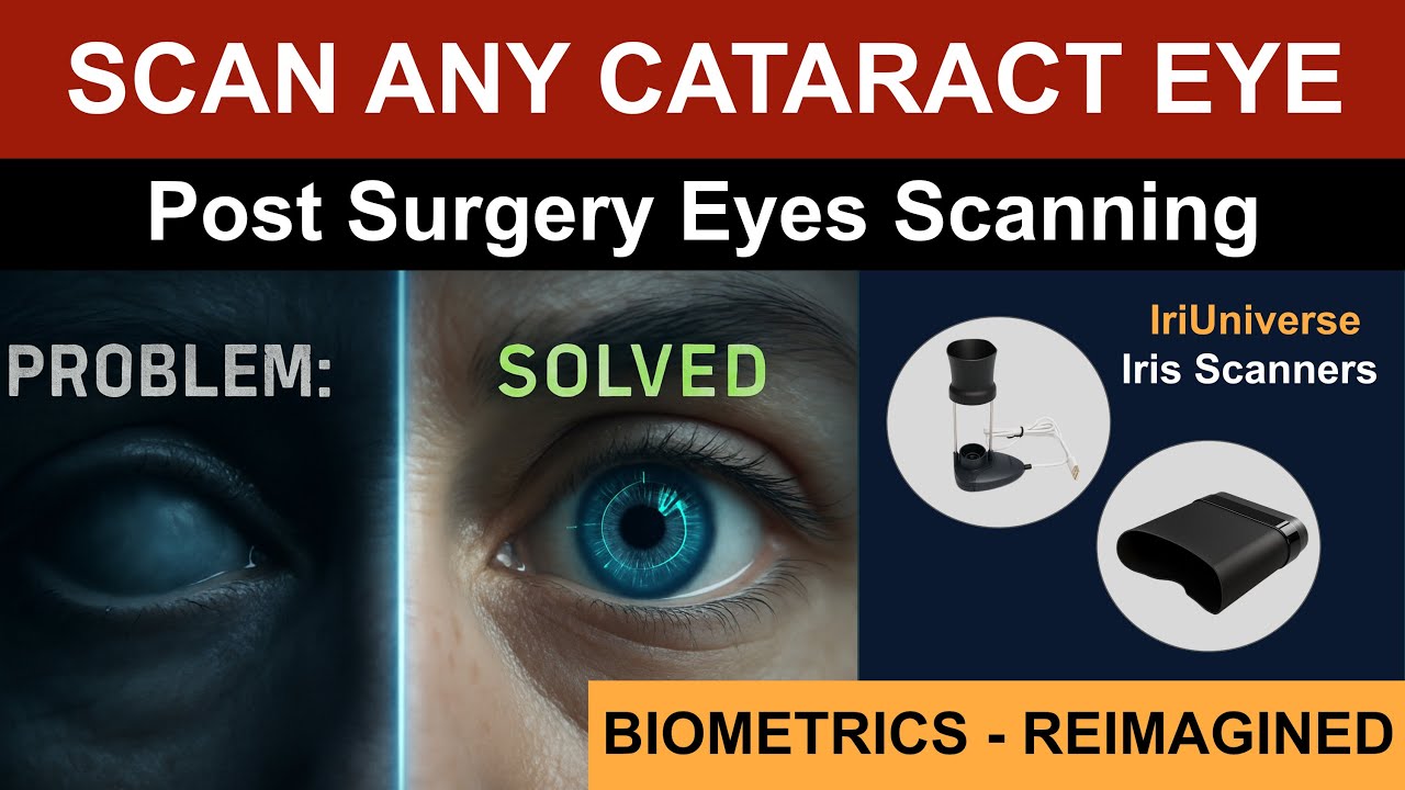 IriUniverse: Iris Capture for Cataract & Post Surgery Eyes with Our ...