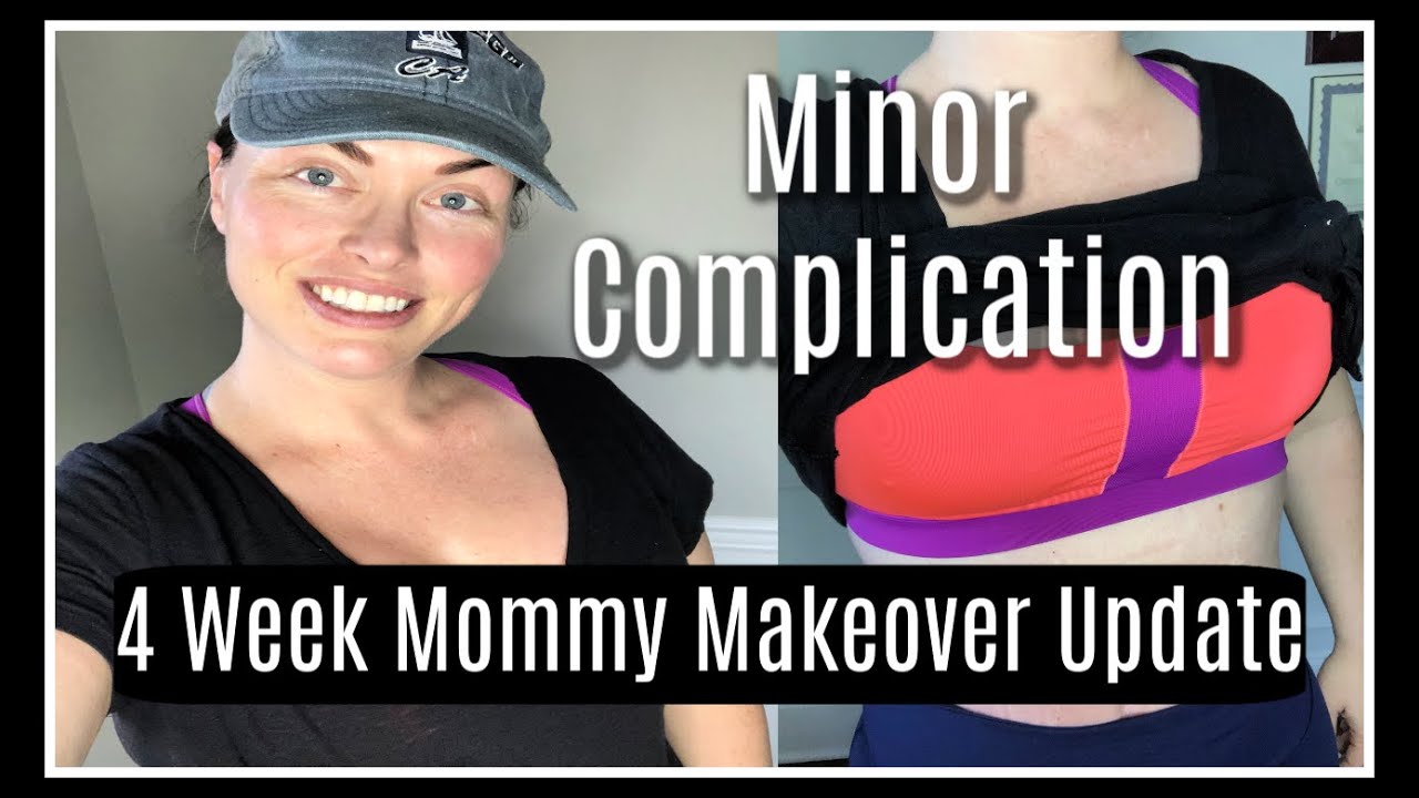 Mommy Makeover Surgery Complications 4 Weeks Post Op Recovery Tummy