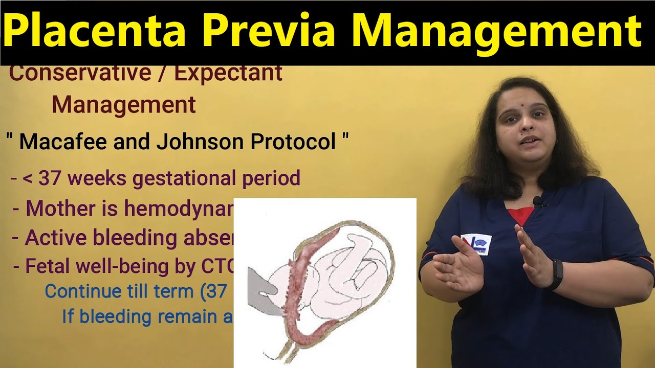 Placenta Previa Management