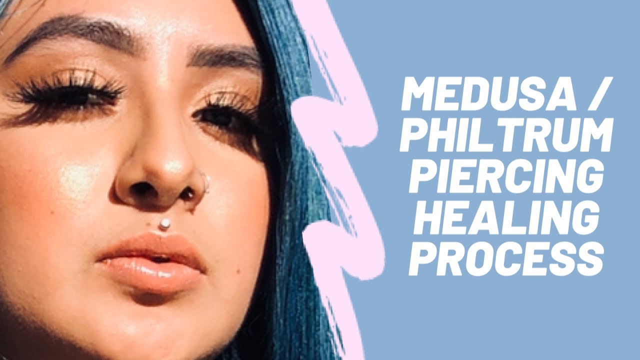 Medusa / Philtrum piercing Healing process ( was supposed to be a ...