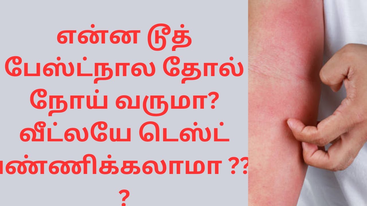 Can we get allergy due to toothpaste???#toothpasteallergy#allergy# ...