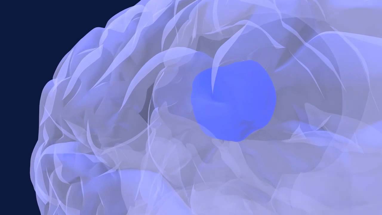 SonoCloud-1 Animation - English Subtitles - YouTube