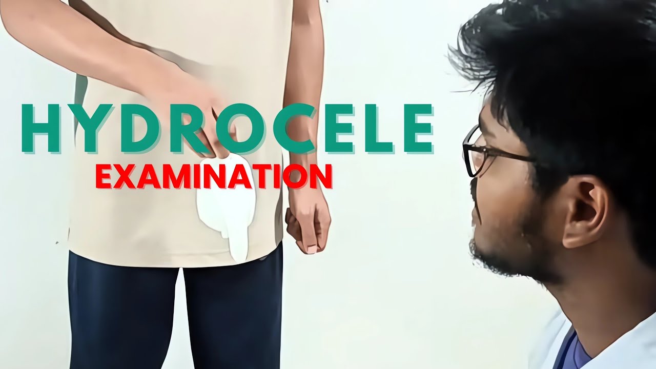 Hydrocele Examination - YouTube