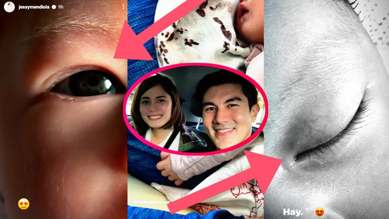 JESSY MENDIOLA AT LUIS MANZANO Proud na Proud Walang CLEFT LIP! Baby ...