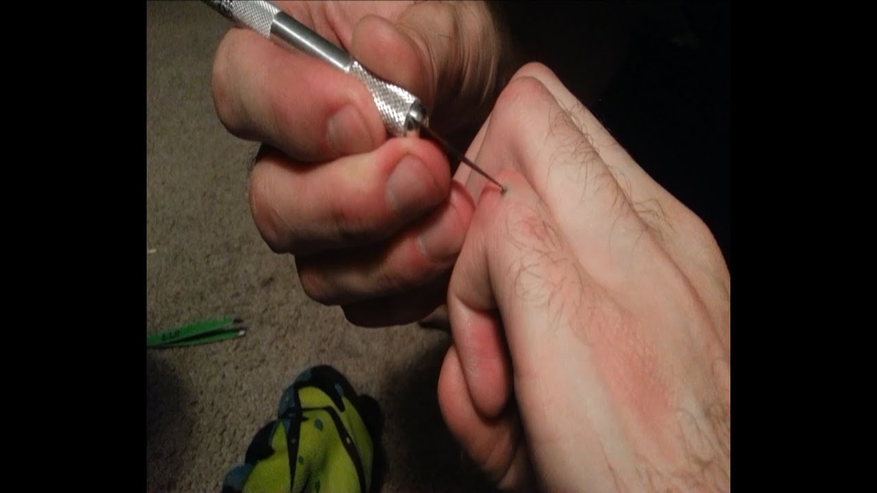 Spike Removal From Hand. Agave Americana. - YouTube