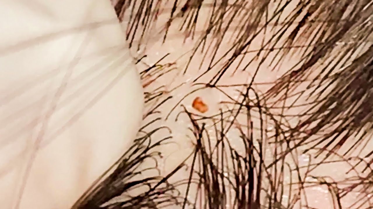 ASMR Checking Scalp & Beard With A Microscope 🔬 | Layered Sounds ☁️ ...