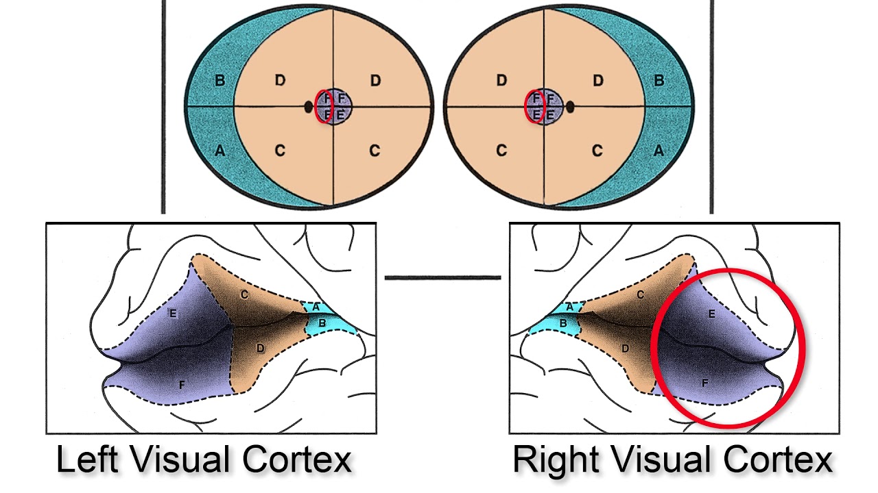 RS Visual Fields Part 4 - Dealing With The Constricted Field - YouTube