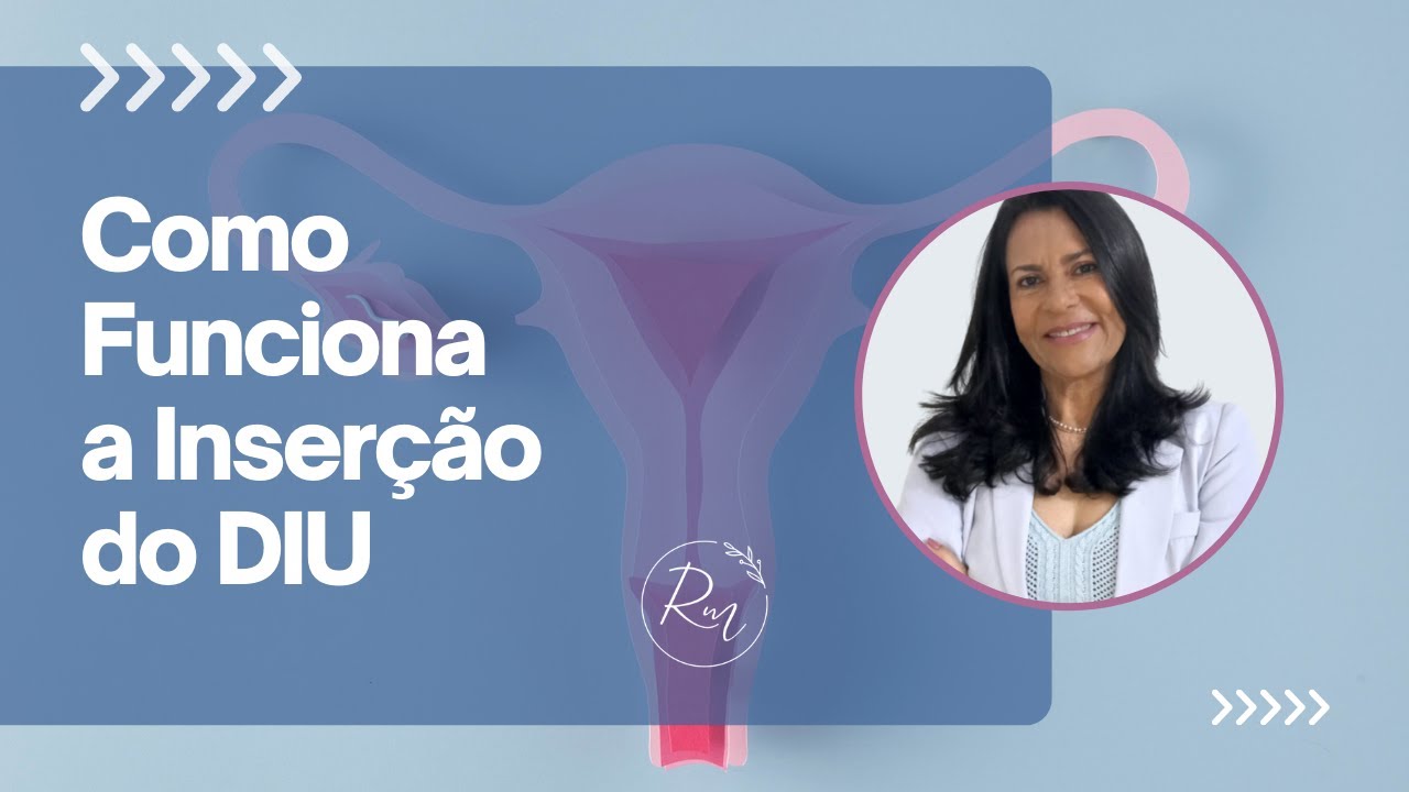 Como Funciona a Inserção do DIU - YouTube