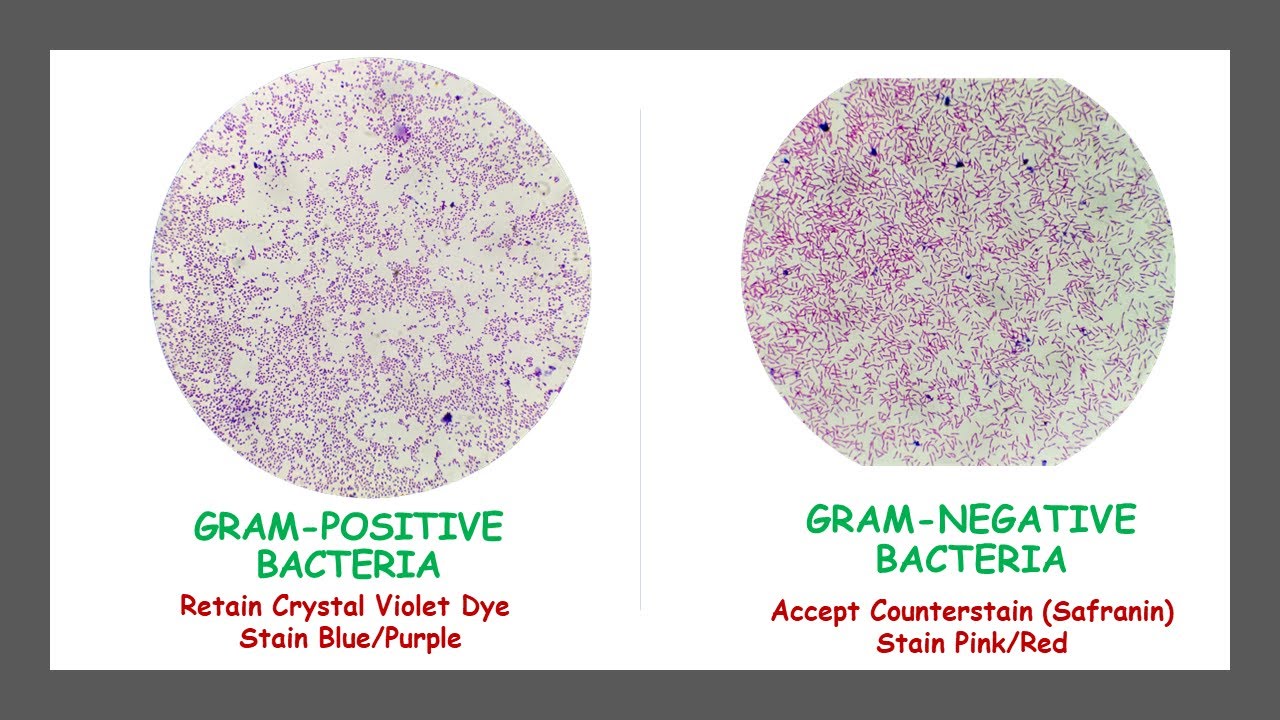 Gram Staining Procedure #Gram Positive Bacteria#Gram Negative Bacteria# ...